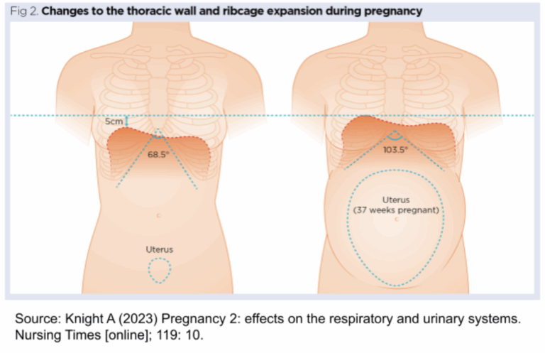 Maternal Cardiac Arrest: Physiologic Considerations, Resuscitation ...